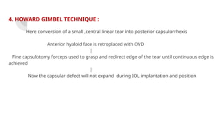 posterior capsular rent and nucleus drop | PPTX