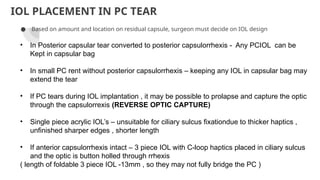 posterior capsular rent and nucleus drop | PPTX