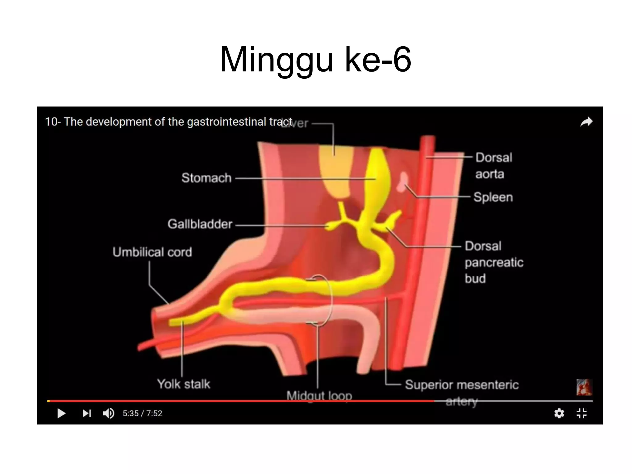 2_KULIAH_Kelainan_Kongenital_Saluran_Ce.ppt