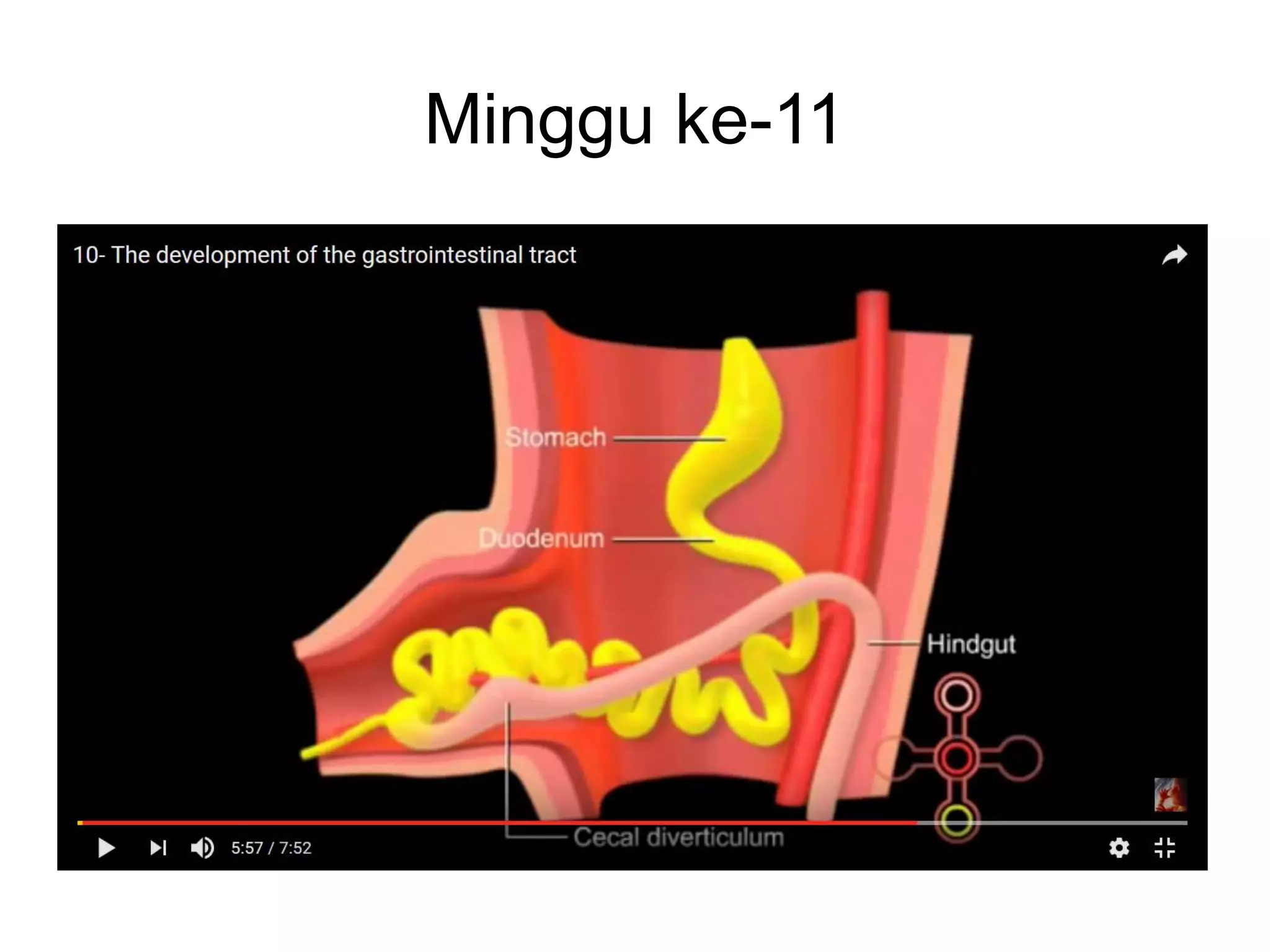 2_KULIAH_Kelainan_Kongenital_Saluran_Ce.ppt