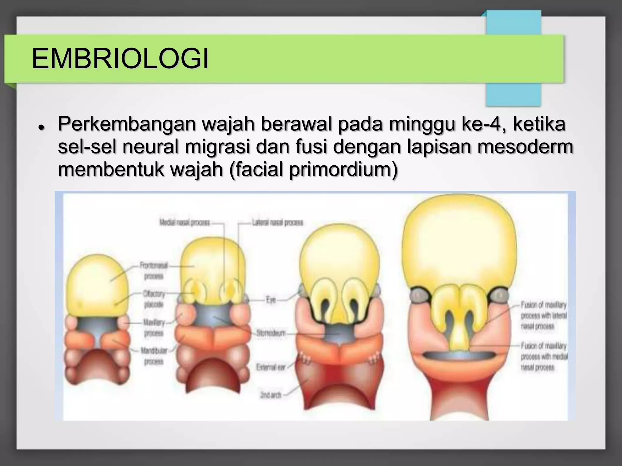 2_KULIAH_Kelainan_Kongenital_Saluran_Ce.ppt