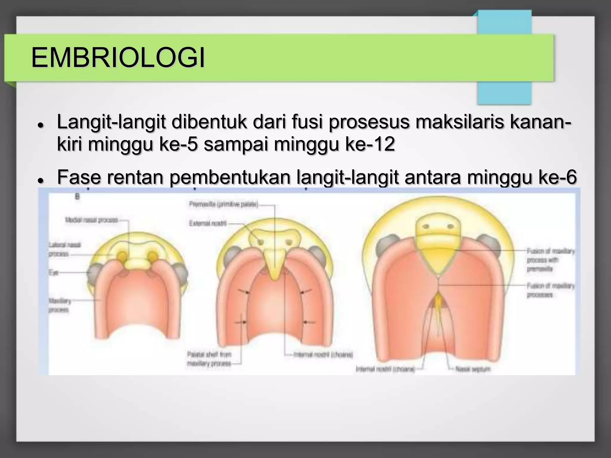 2_KULIAH_Kelainan_Kongenital_Saluran_Ce.ppt