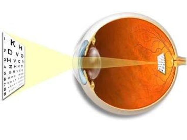 Chapter 14 The Human Eye Lesson 2 - Light Detection | PPT | Eye and ...