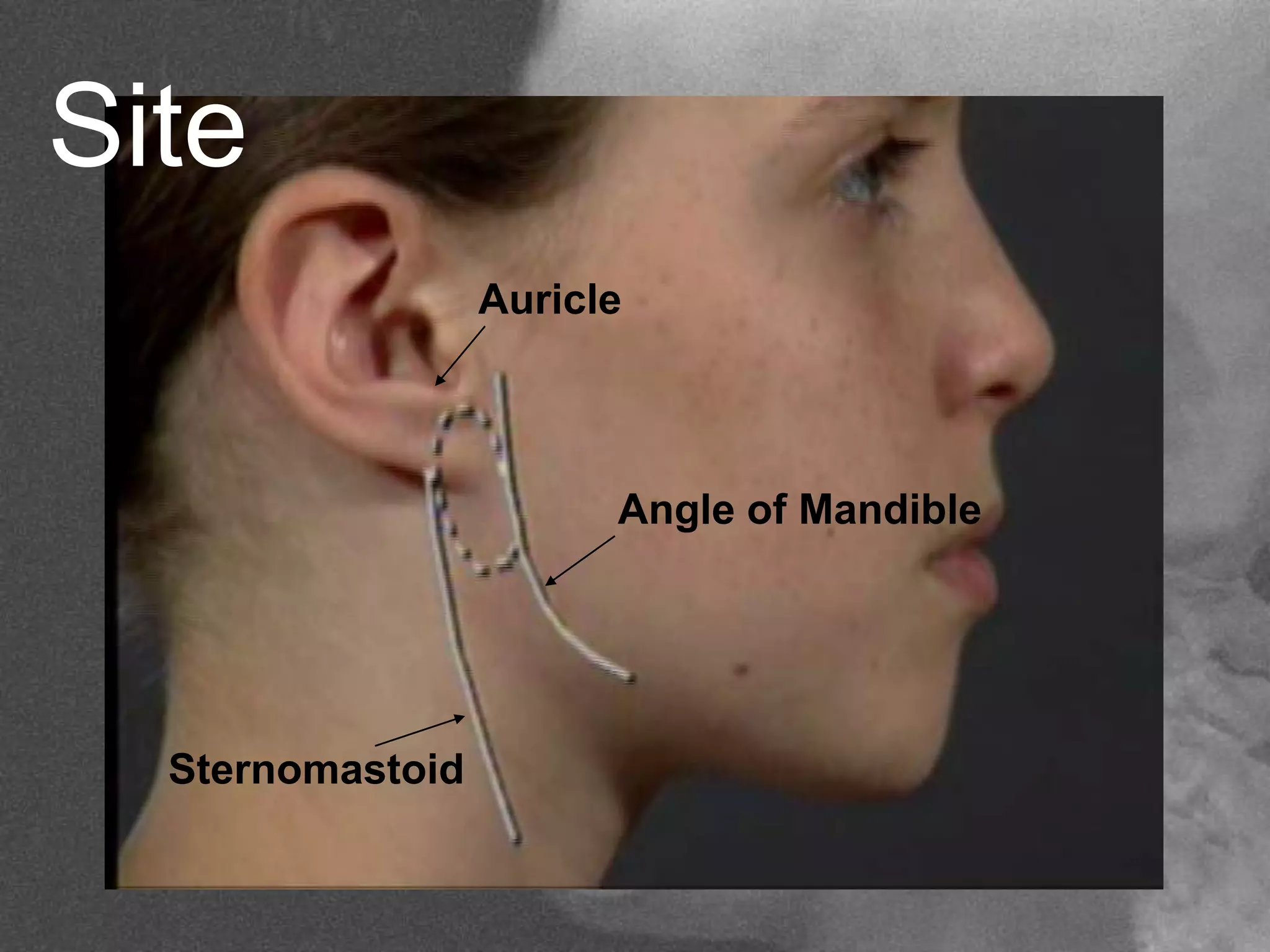 Major salivary gland by Dr.Hardik Rupareliya | PPT