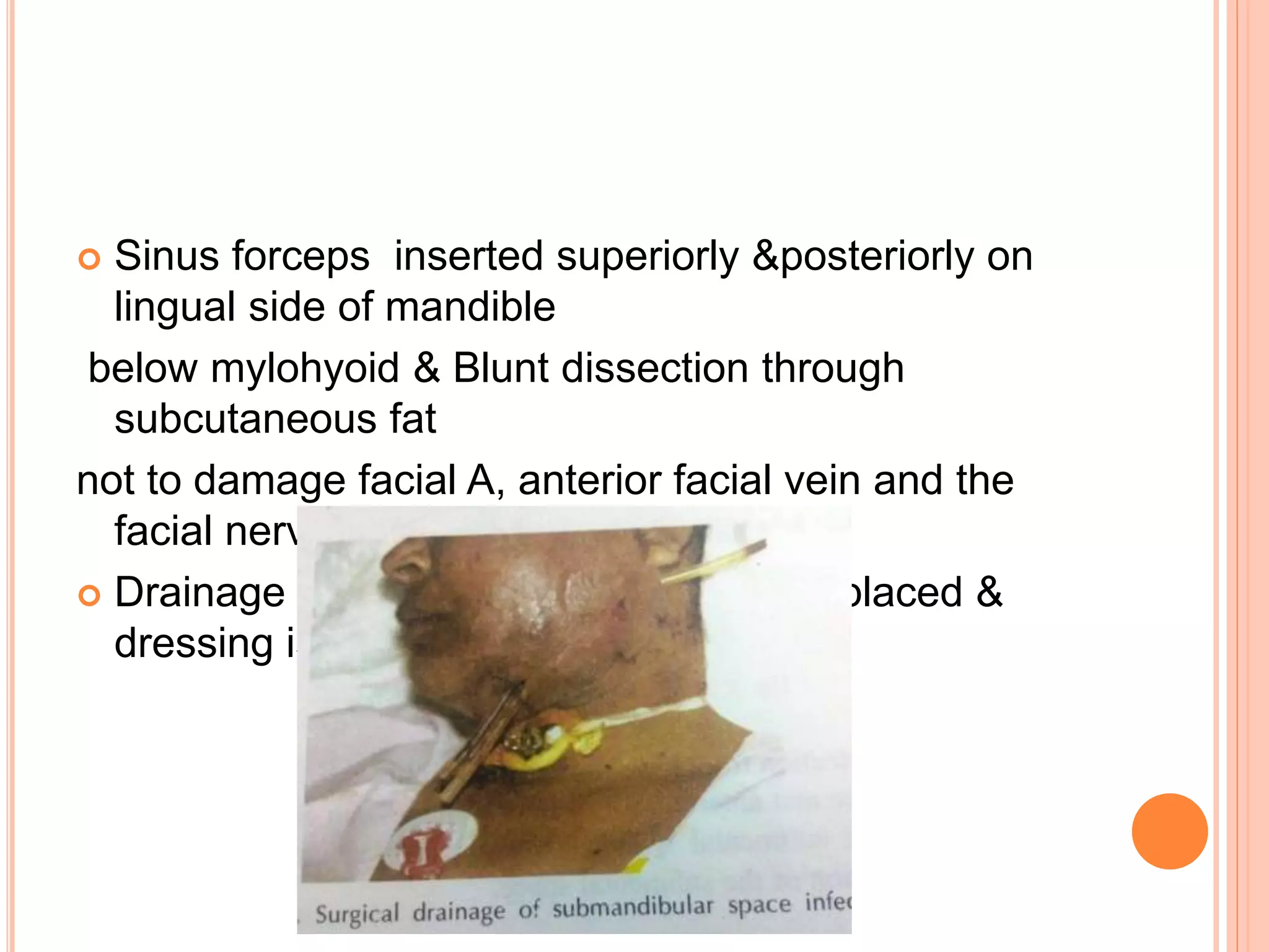 2 mandibular_spaceinfection-.pptx