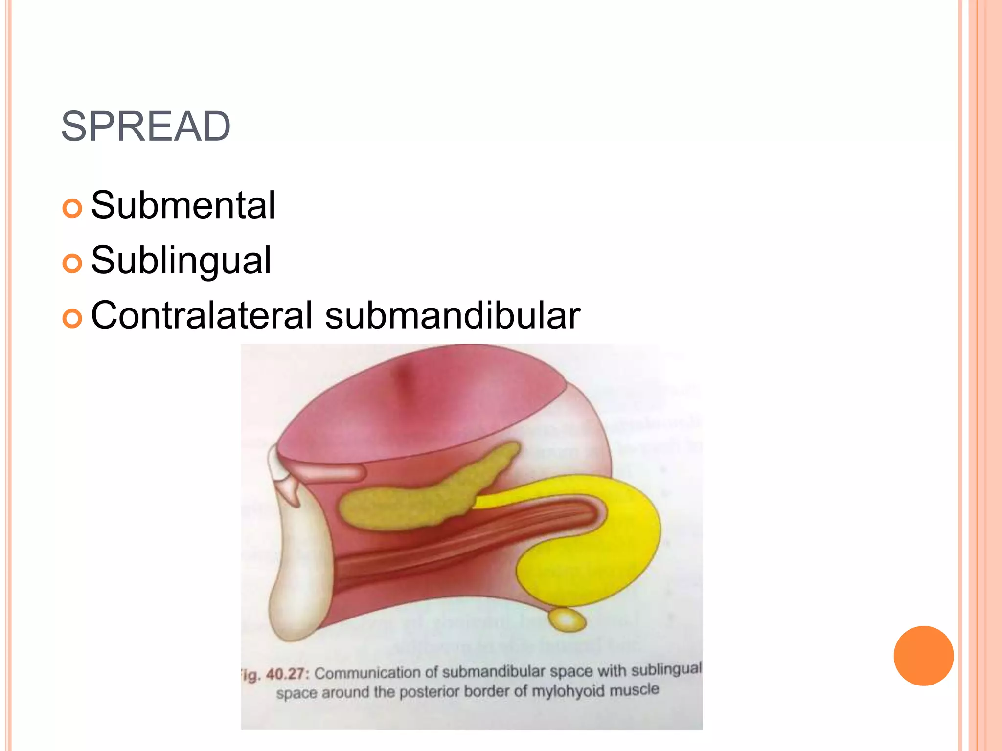 2 mandibular_spaceinfection-.pptx