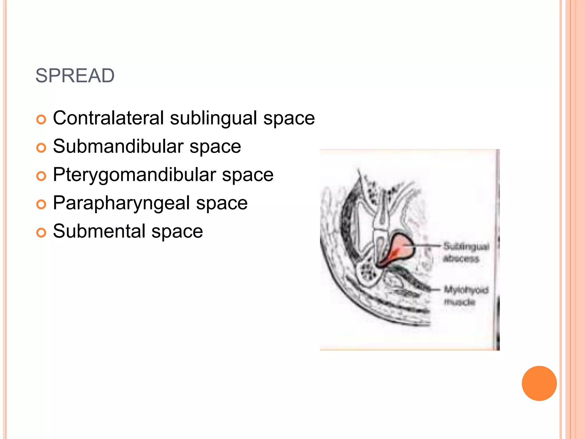 2 mandibular_spaceinfection-.pptx