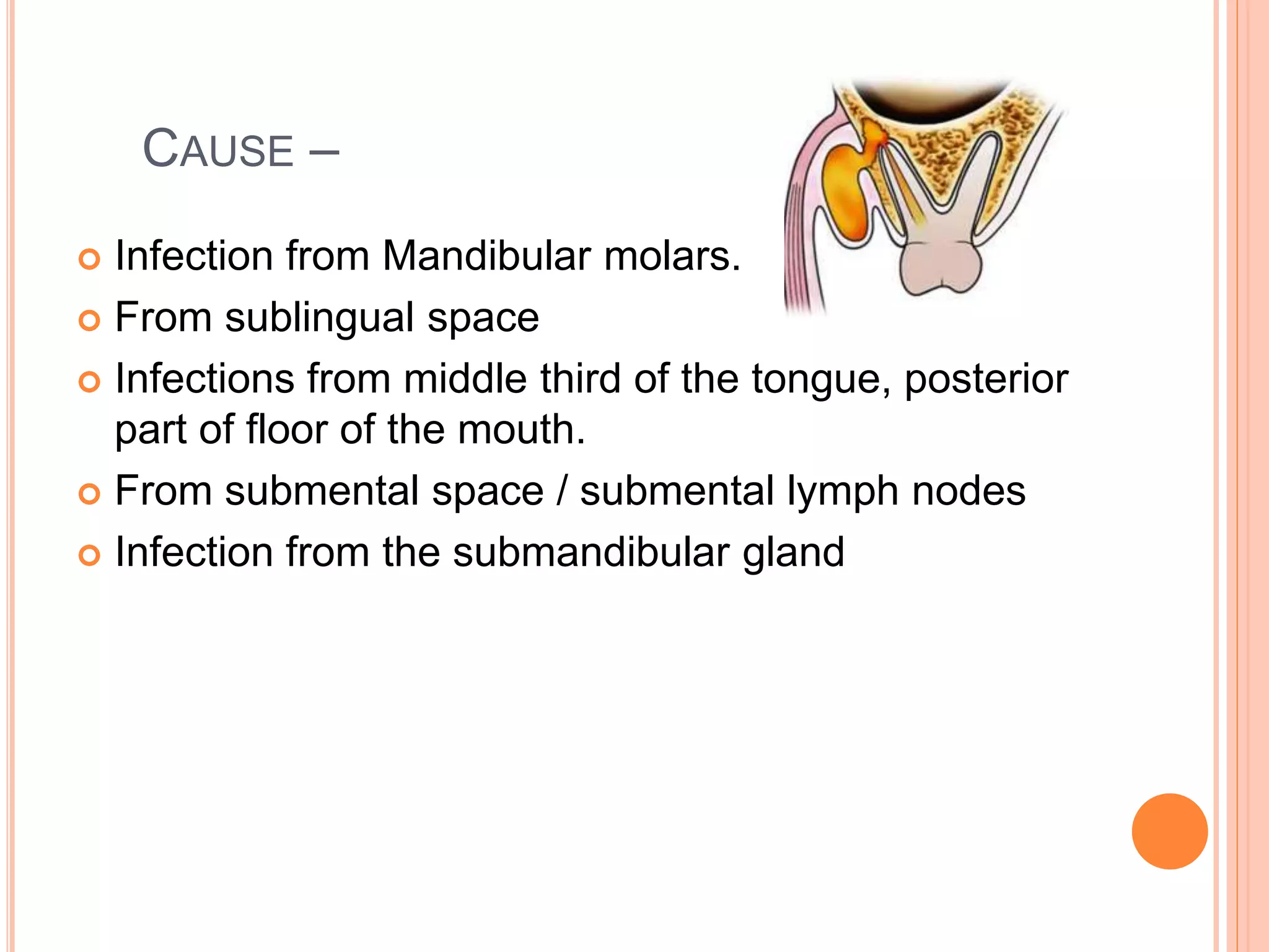 2 mandibular_spaceinfection-.pptx