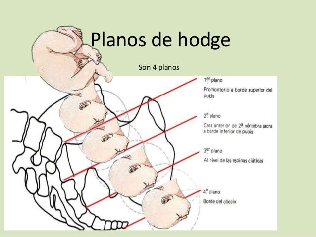 Planos De Hodge