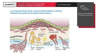 Fisiopatología de la placa de ateroma | PDF