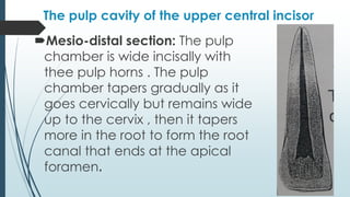 2 maxillary 1st incisor | PDF