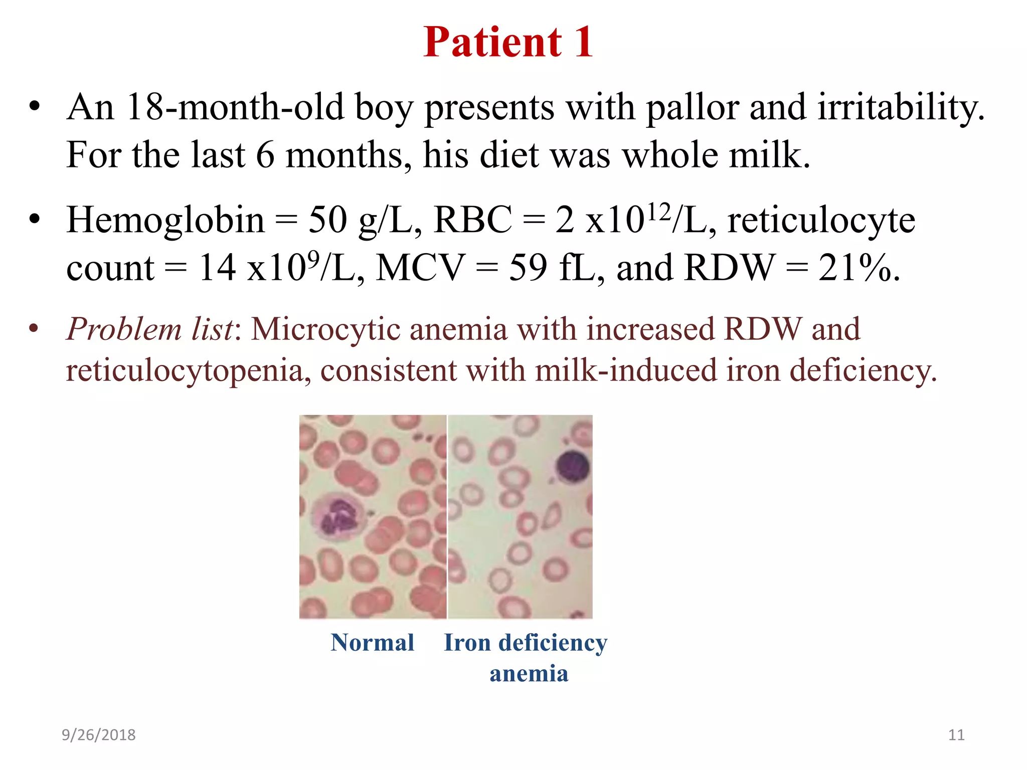 2 microcytic anemia i-iron deficiency.ppt