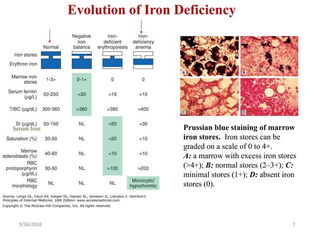 2 microcytic anemia i-iron deficiency.ppt