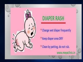 MIDWIFERY-MINOR DISORDERS OF NEWBORN BABY | PPT