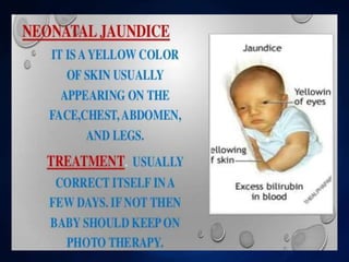 MIDWIFERY-MINOR DISORDERS OF NEWBORN BABY | PPT