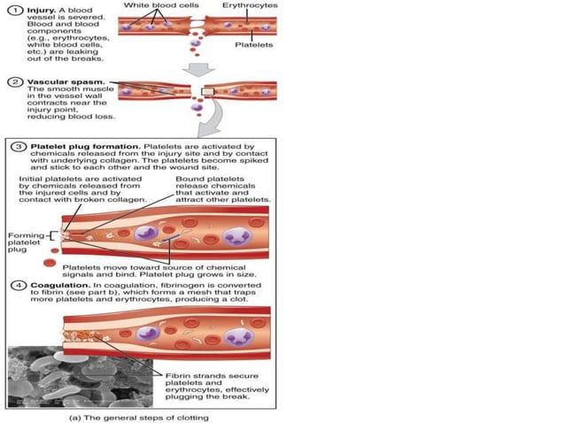 Interpretation of tests in coagulation disorders | PPTX | Blood ...