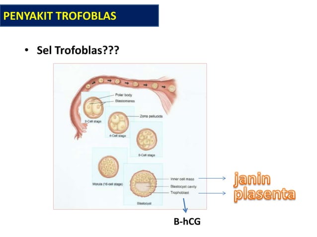Mola hidatidosa dan Koriokarsinoma, endometriosis | PDF