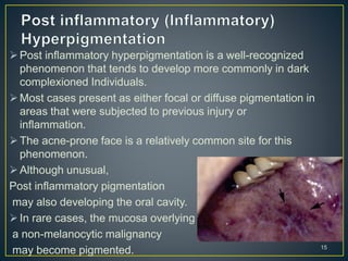 Multifocal diffuse pigmentation in oral medicine | PPT
