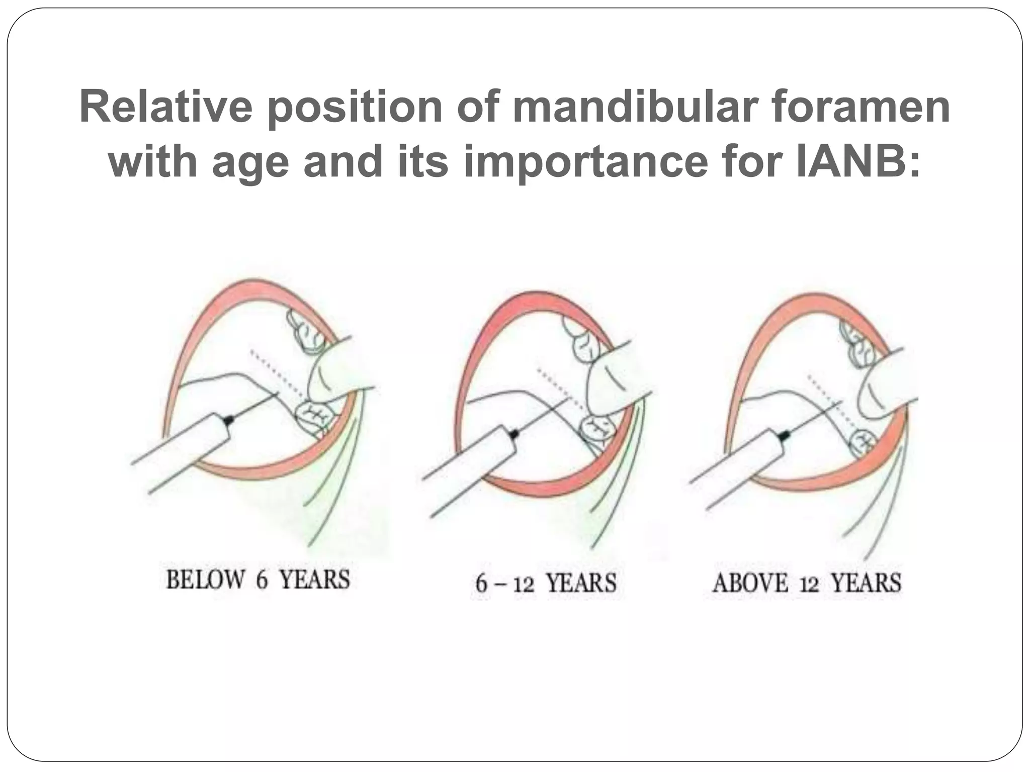 Development of mandible | PPTX