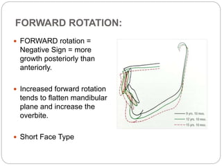 Development of mandible | PPTX