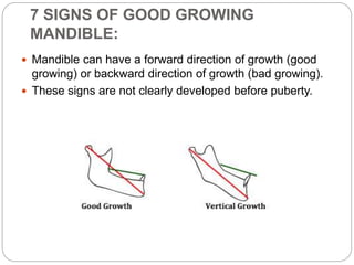 Development of mandible | PPTX