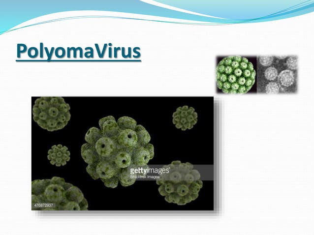 polyoma virus | PPTX