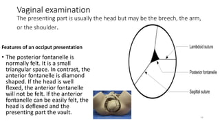 2nd and 3rd stage of labour final.pdf