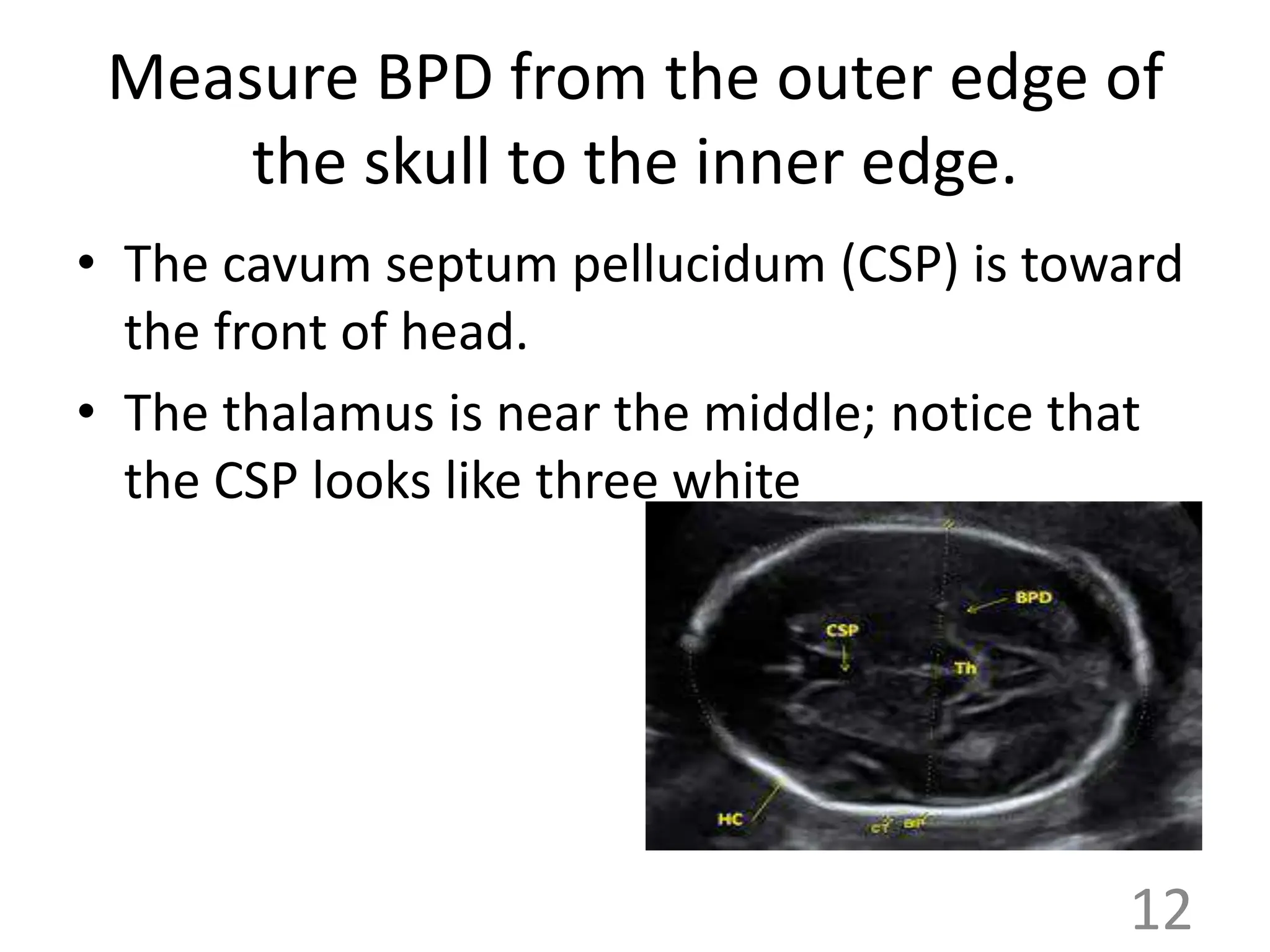 2ND AND 3RD TRIMESTER DATING FOR STARTER.pptx