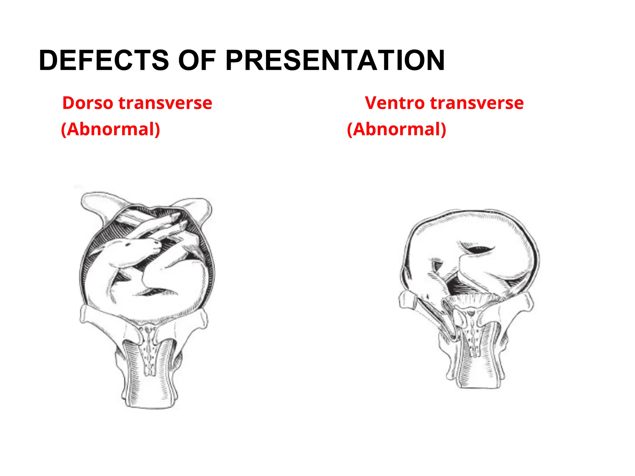 2nd Fetal Presentations.ppt kkkkkkkkkkkk | PPT