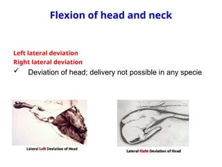 2nd Fetal Presentations.ppt kkkkkkkkkkkk | PPT
