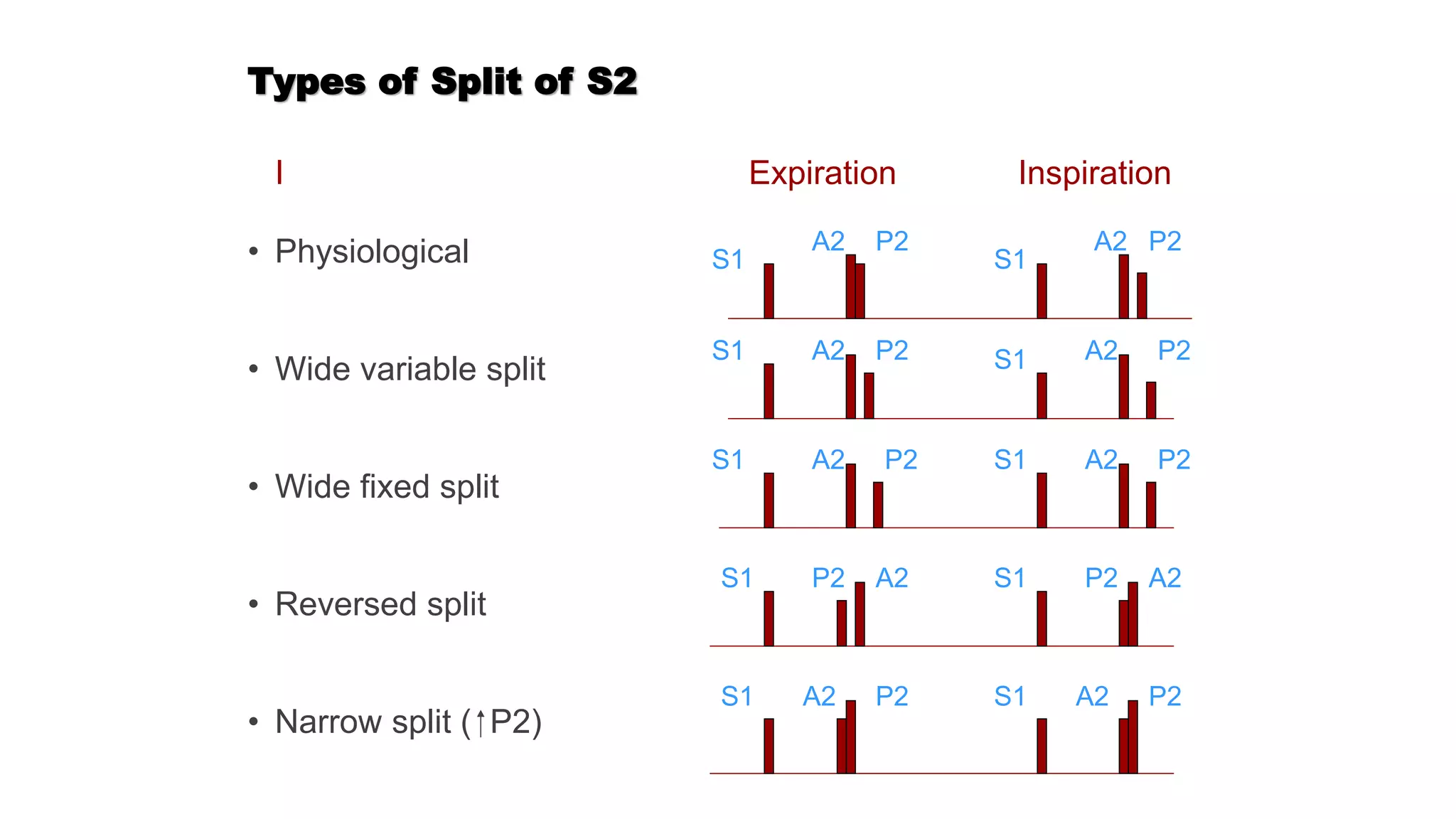 2 nd heart sound S2.pptx