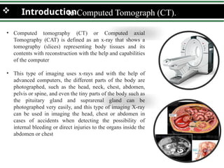 2nd lecture (ct).pptxghhnmkkiubvdekkkigrrr | PPTX