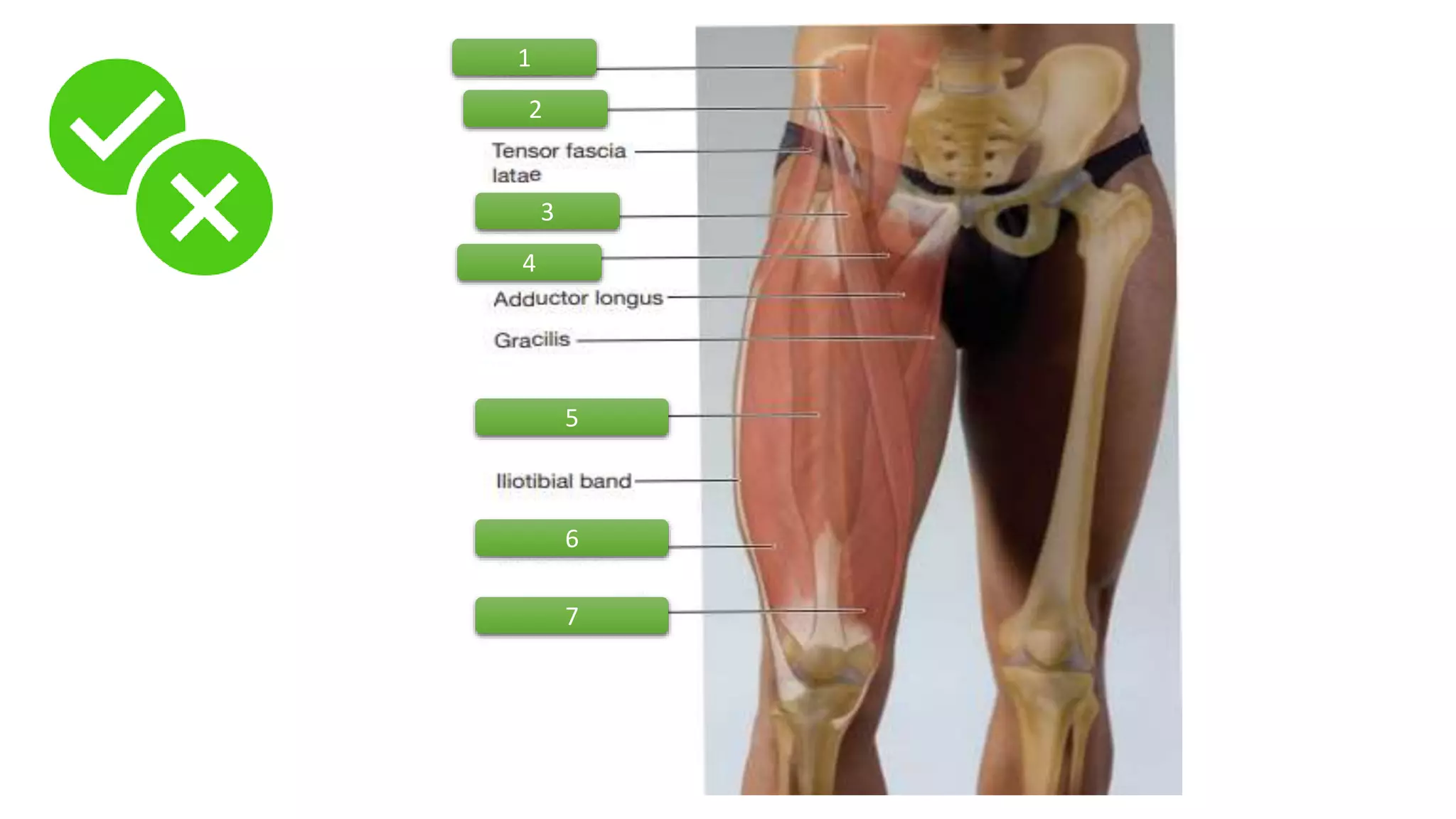 anatomy of thigh region with Dr.Ameera Al-Humidi.pptx