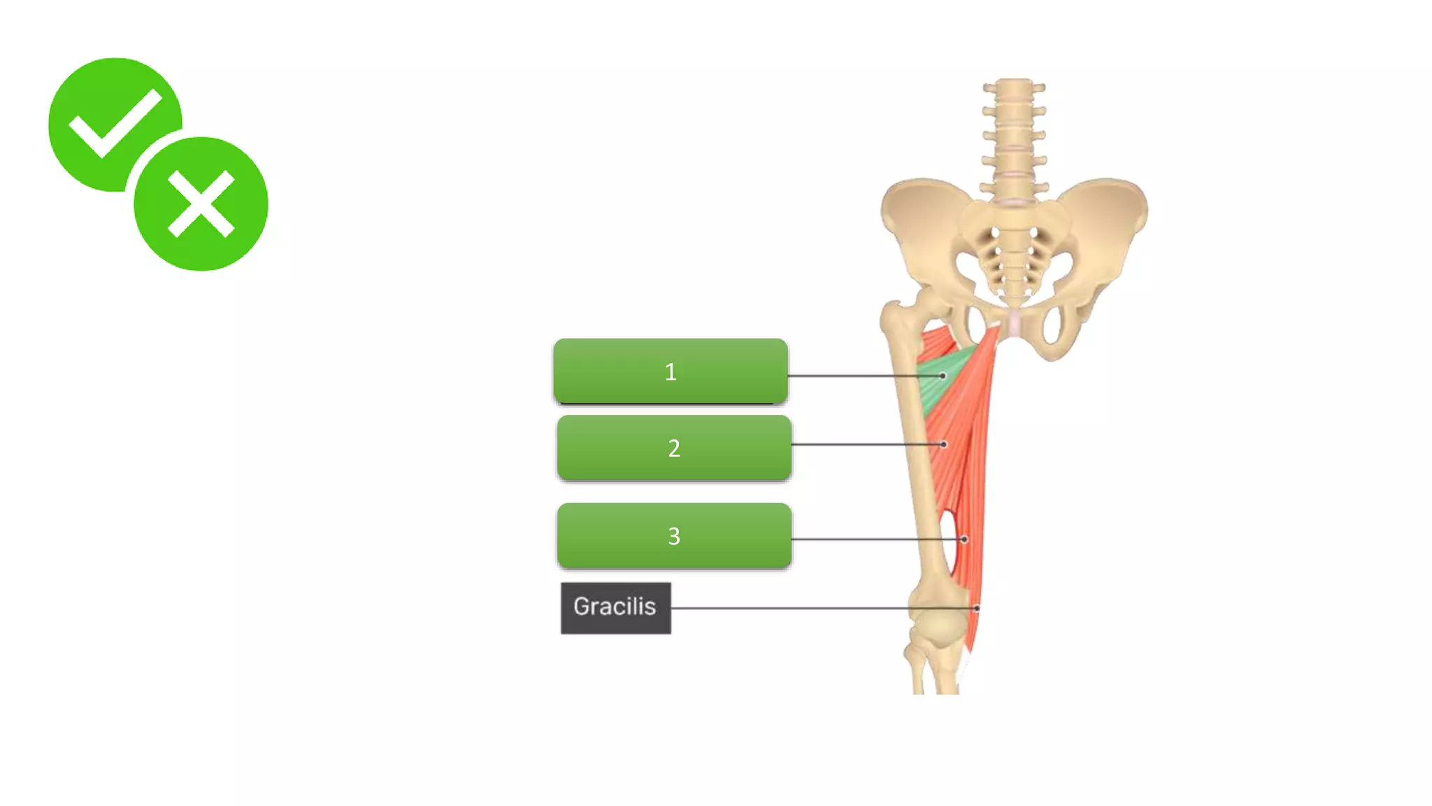 anatomy of thigh region with Dr.Ameera Al-Humidi.pptx