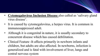 salivary gland disorder.pptx