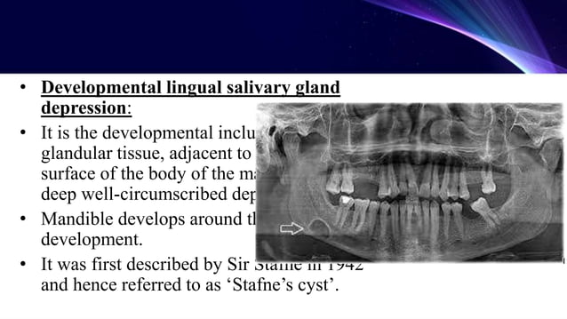 salivary gland disorder.pptx | Dental Health | Diseases and Conditions