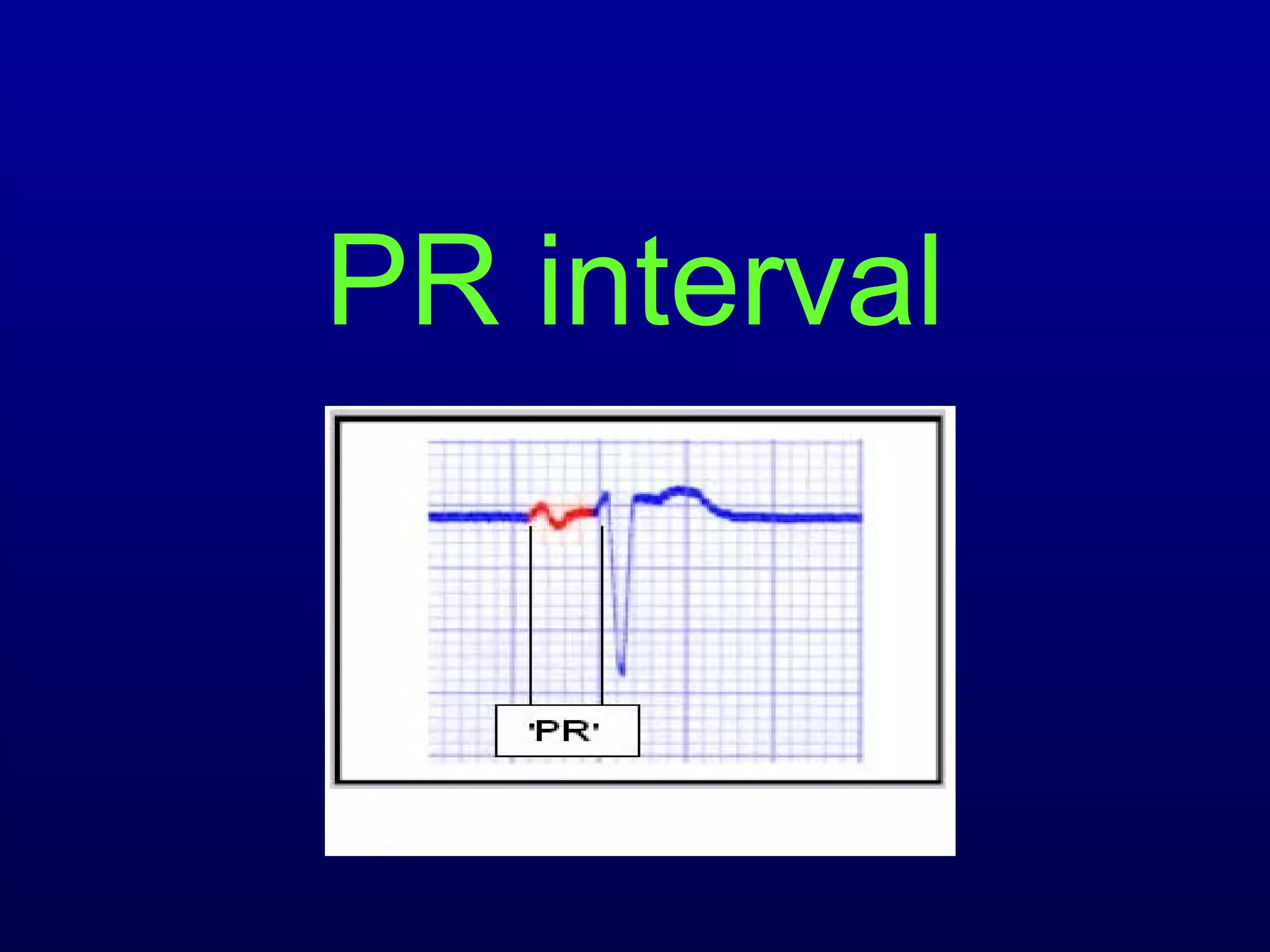 2nd part ECG basics PR interval and heart block | PPT