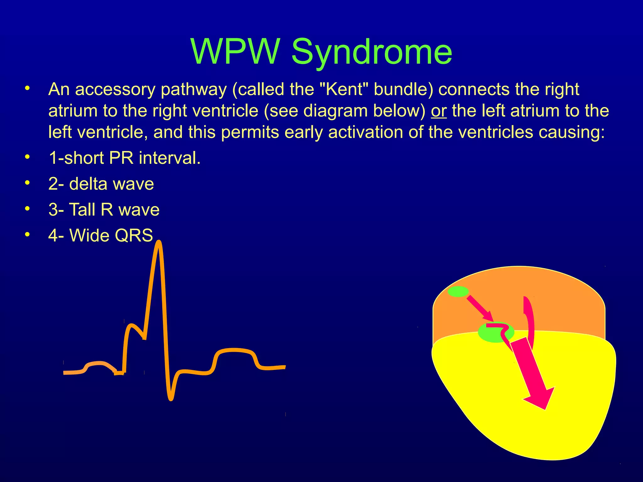 2nd part ECG basics PR interval and heart block | PPT