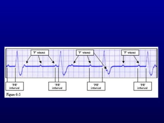 2nd part ECG basics PR interval and heart block | PPT