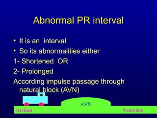 2nd part ECG basics PR interval and heart block | PPT