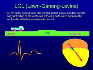 2nd part ECG basics PR interval and heart block | PPT
