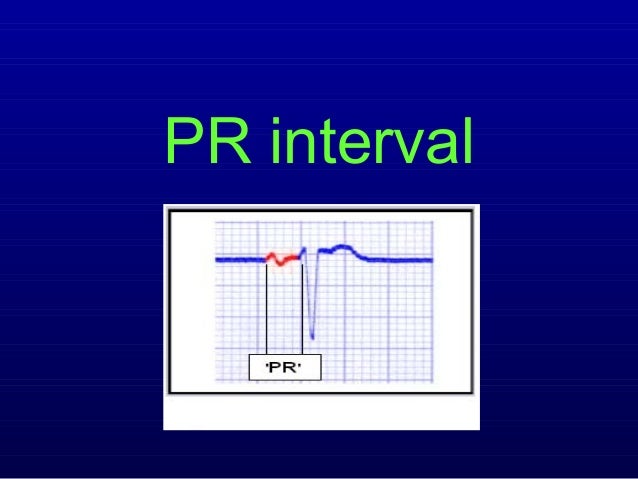 2nd part ECG basics PR interval and heart block