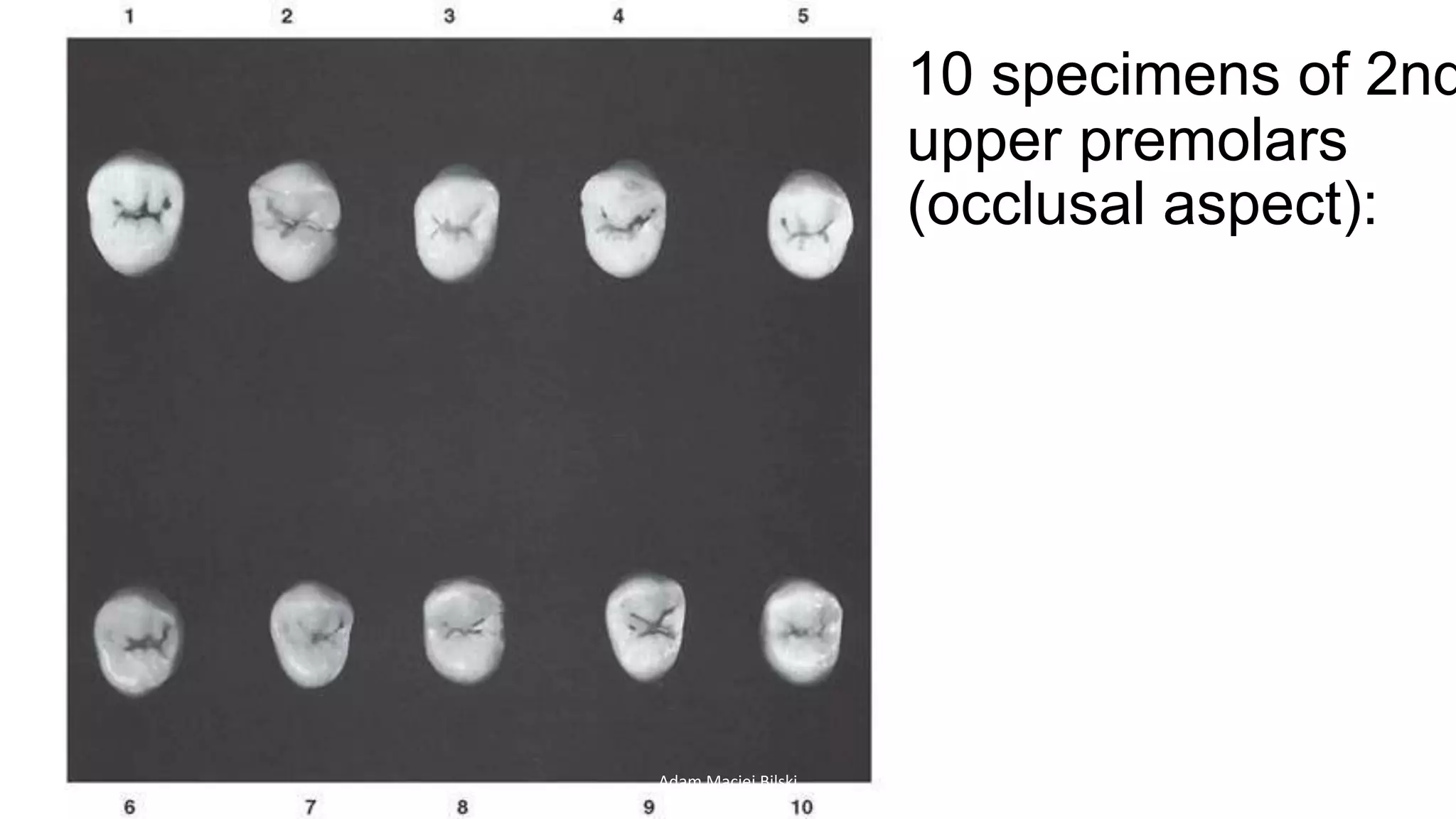 2nd Upper Premolar Anatomy | PPTX