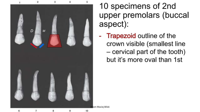2nd Upper Premolar Anatomy | PPTX