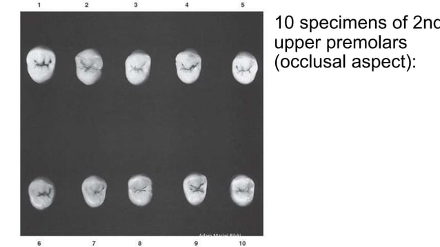 2nd Upper Premolar Anatomy | PPTX