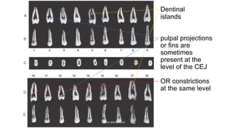 2nd Upper Premolar Anatomy | PPTX