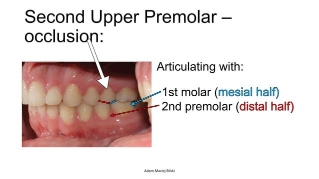 2nd Upper Premolar Anatomy | PPTX