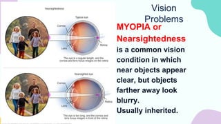 2nd Quarter Health Problems.pptx