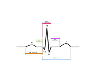Efficient VLSI Architecture for Data Analysis of ECG | PPT | Pregnancy | Reproductive Health