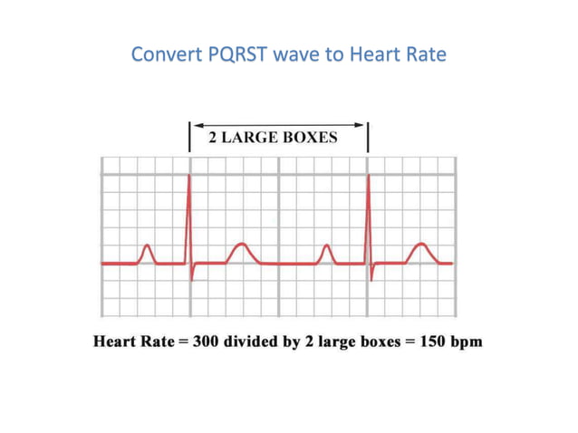 Efficient Vlsi Architecture For Data Analysis Of Ecg Ppt Pregnancy